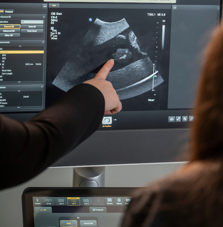 Diagnostic Medical Sonography (AAS) - University of Saint Francis, Fort ...